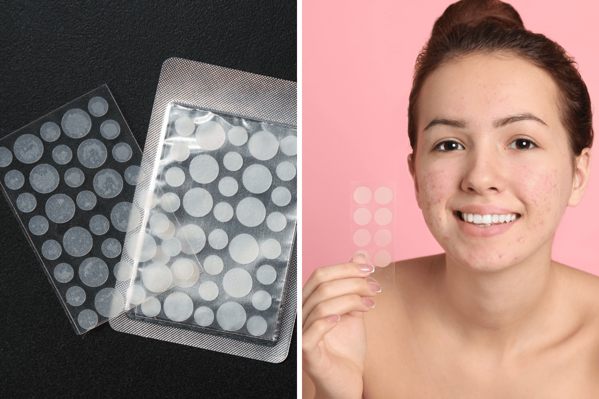 Which Pimple Patch Works the Best?